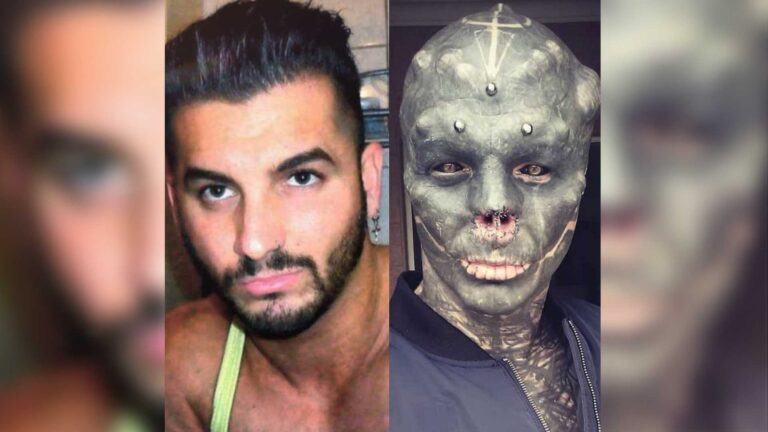 Before & After Gone Wrong: When Plastic Surgery Pushes the Limit ...