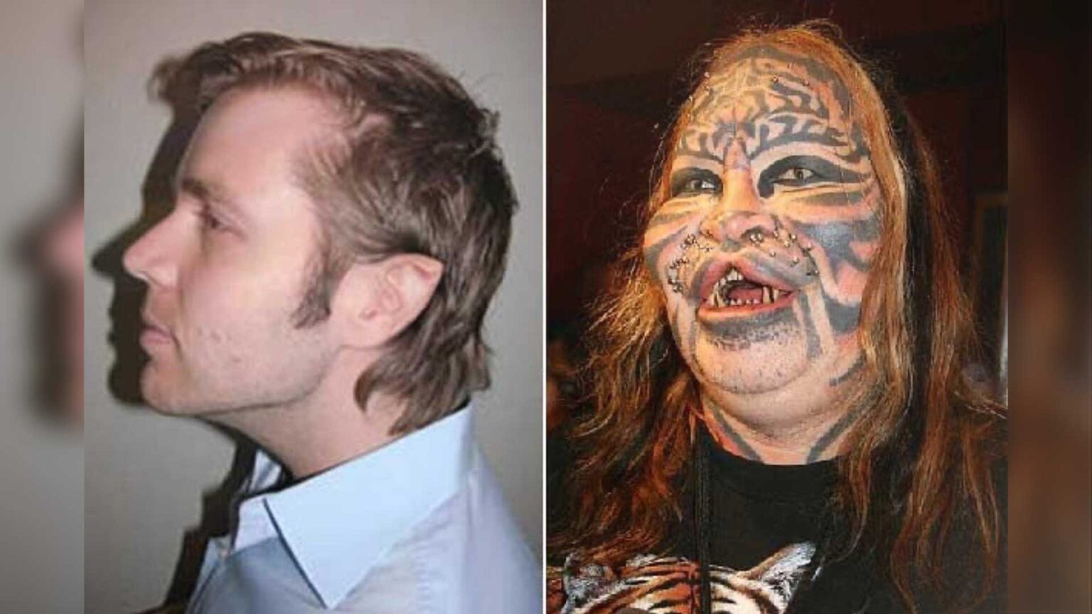 Before & After: When Cosmetic Surgery Crosses the Line - Lifestyle Fortress