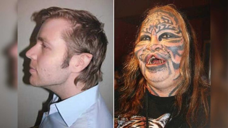 Before & After Gone Wrong: When Plastic Surgery Pushes the Limit ...
