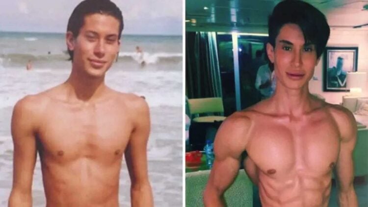 Before & After Gone Wrong: When Plastic Surgery Pushes the Limit ...